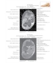 Cross Section of the Ankle and Foot: Coronal View