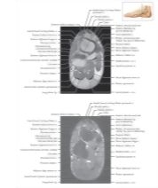 Cross Section of the Ankle and Foot: Coronal View