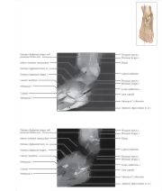 Cross Section of the Ankle and Foot: Coronal View