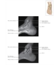 Cross Section of the Ankle and Foot: Coronal View