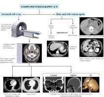Computed Tomography (CT) Overview