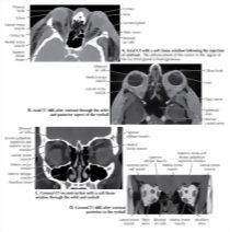 Imaging of the Orbit