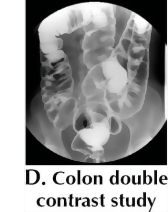 Colon Double Contrast Study
