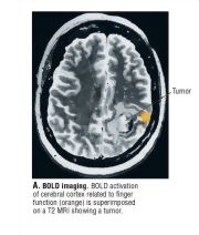 BOLD Imaging