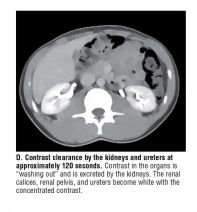 Use of Contrast In Abdominal Imaging Studies