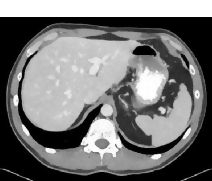 Upper Gastrointestinal CT Studies