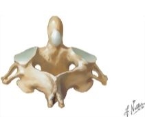 Axis (C2) Posterosuperior View