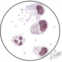 donovan bodies klebsiella granulomatis