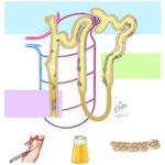 Acute Tubular Necrosis: Causes, Pathophysiology, and Clinical Features