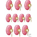 Pyeloplasty and Endopyelotomy