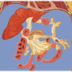 Peritoneal Cavity Abdomen Coronal 5