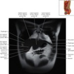Abdomen Coronal 2