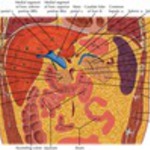 Abdomen Coronal 9
