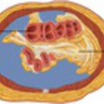 Peritoneal Cavity Abdomen Coronal 1