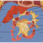 Peritoneal Cavity Abdomen Coronal 4