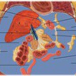 Peritoneal Cavity Abdomen Coronal 6