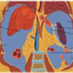 Peritoneal Cavity Abdomen Coronal 7