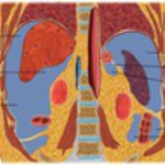 Peritoneal Cavity Abdomen Coronal 8