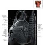 Peritoneal Cavity Pelvis Sagittal 6