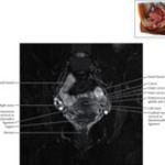 Female Pelvis Coronal 7