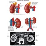 Renal Vasculature (Continued)