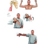 Biceps, Tendon Tears, and SLAP Lesions: Presentation and Physical ...