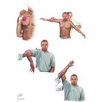 Impingement Syndrome and the Rotator Cuff: Presentation and Diagnosis