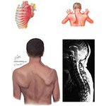 Long Thoracic and Spinal Accessory Nerves