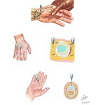 Thumb CMC Injection, Digital Block, and Flexor Sheath Injection