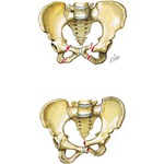 Injury to Pelvis: Straddle Fracture and Lateral Compression Injury