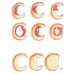 Types of Meniscal Tears and Discoid Meniscus Variations