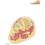 Cross-Sectional Anatomy of Ankle and Foot (Continued)