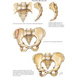 Injury to Pelvis: Stable Pelvic Ring Fractures