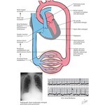 The Hyperthyroid Heart