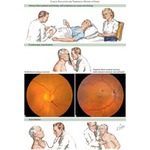 Clinical Evaluation and Therapeutic Options in Stroke