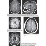 Diagnosis: MRI in Multiple Diagnosis