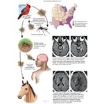 Eastern Equine Encephalitis