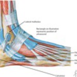 Fibular (Peroneus) Tendons at Ankle