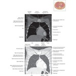 Soft Tissue and Lung Coronal 4