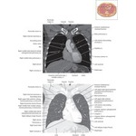 Soft Tissue and Lung Coronal 10