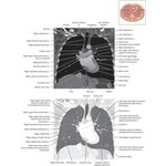 Soft Tissue and Lung Coronal 17