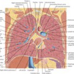 Soft Tissue and Lung Coronal 21