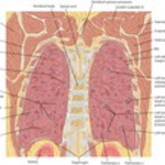 Soft Tissue and Lung Coronal 32