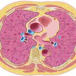 Cisterna Chyli/Thoracic Duct Axial 2