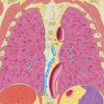 Cisterna Chyli/Thoracic Duct Coronal 1