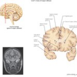 A. Coronal Sections Through the Forebrain: Level 1 - Genu of Corpus ...