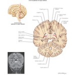 A. Coronal Sections Through the Forebrain: Level 10 - Splenium of ...