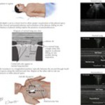 E-FAST Thoracic Examination