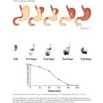 Diagnostic Aids in Gastric Disorders: Gastric Emptying Scintigraphy