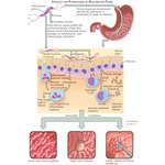 Helicobacter Pylori infection: Etiology and Pathogenesis of ...